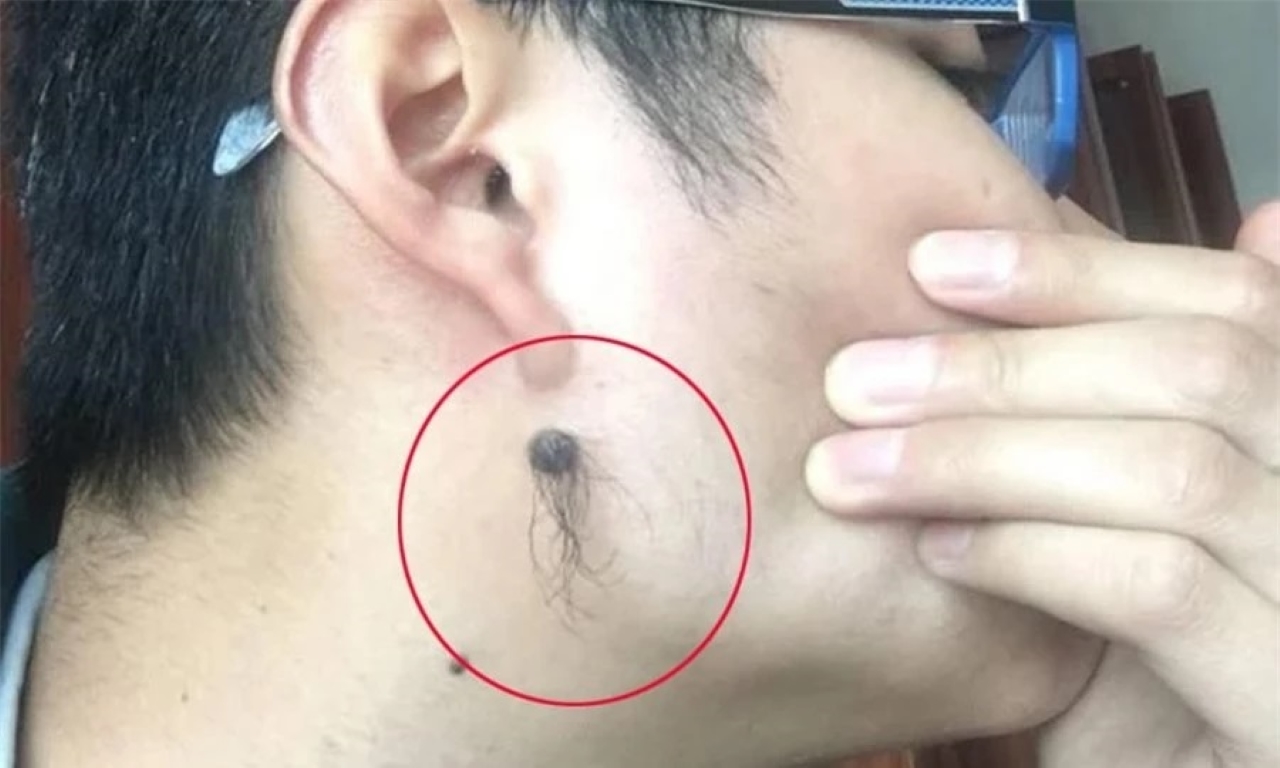 Mọc lông ở 4 vị trí này trên cơ thể càng nhiều thì càng phát tài, phú ...