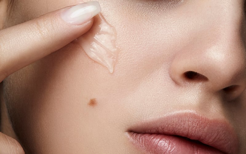 5 cách hỗ trợ làm mờ thâm lâu năm, giúp làn da đều màu và rạng rỡ hơn
